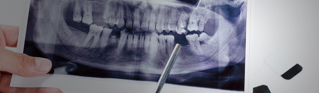 Full Mouth Reconstruction – Dr. Richard L. Dailey